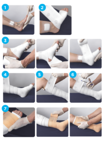 Urgo Medical | UrgoKTwo and UrgoKTwo Reduced details