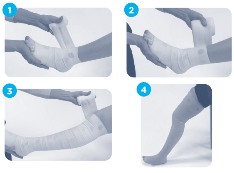 Urgo Medical | UrgoKTwo and UrgoKTwo Reduced details