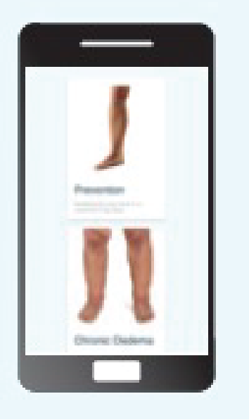 Urgo Medical | Urgo Compression Hosiery prepares wounds for healing